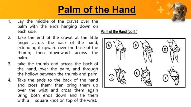 BANDAGING: TRIANGULAR BANDAGING AND CRAVAT, TYPES OF KNOTS | PPTX