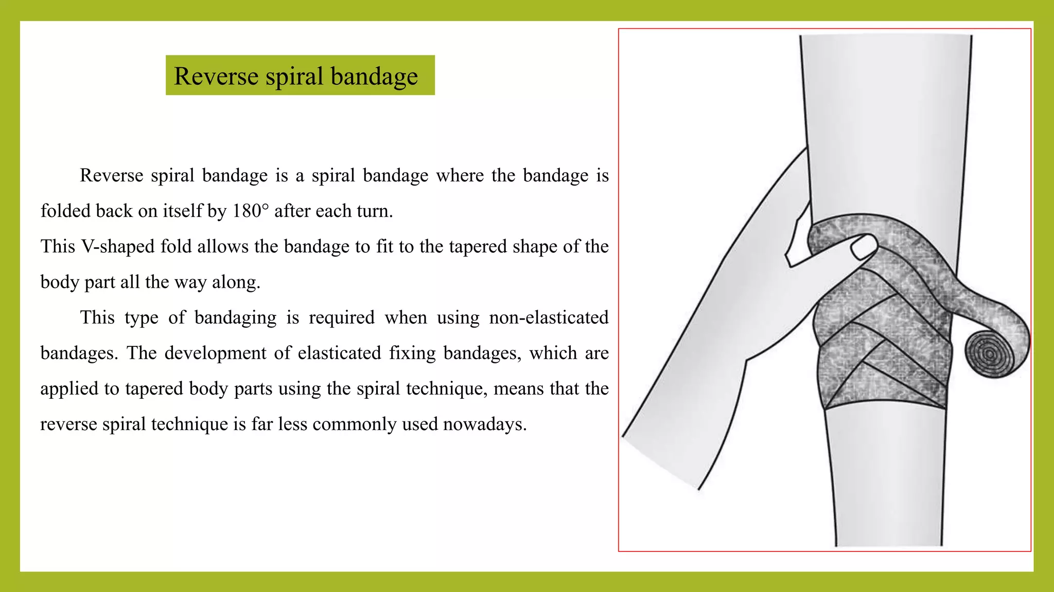 Bandages and its types | PPTX
