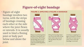 BANDAGES , types of bandages , special bandages | PPTX