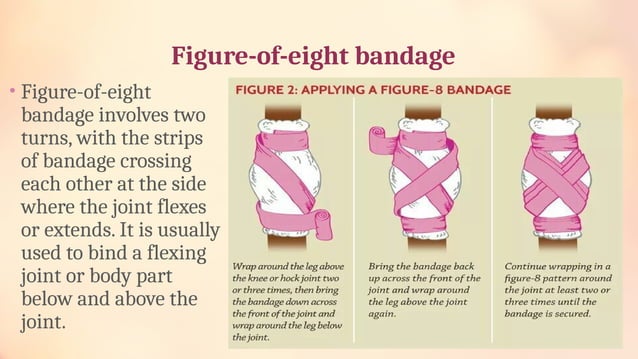 BANDAGES , types of bandages , special bandages | PPTX | First Aid ...