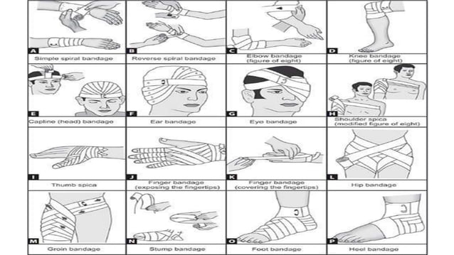 Bandages and Binders [Autosaved].pptx