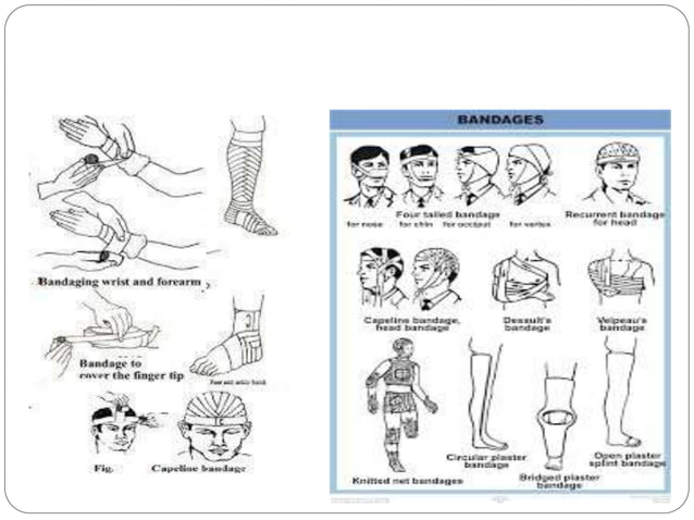 bandages for first Aid treatment.pptx | First Aid | Injuries
