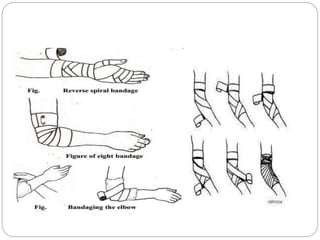 bandages for first Aid treatment.pptx