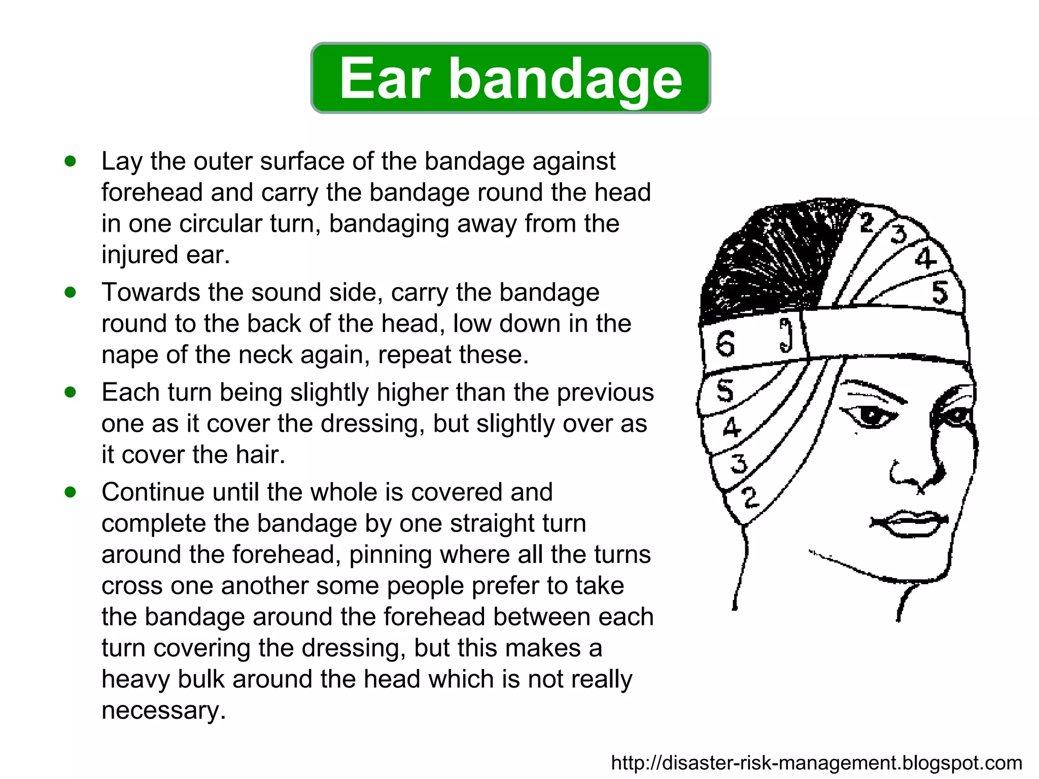 Bandaging | PPT