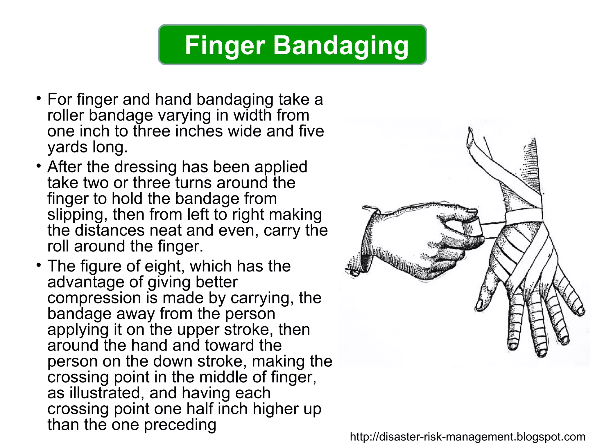Bandaging | PPT