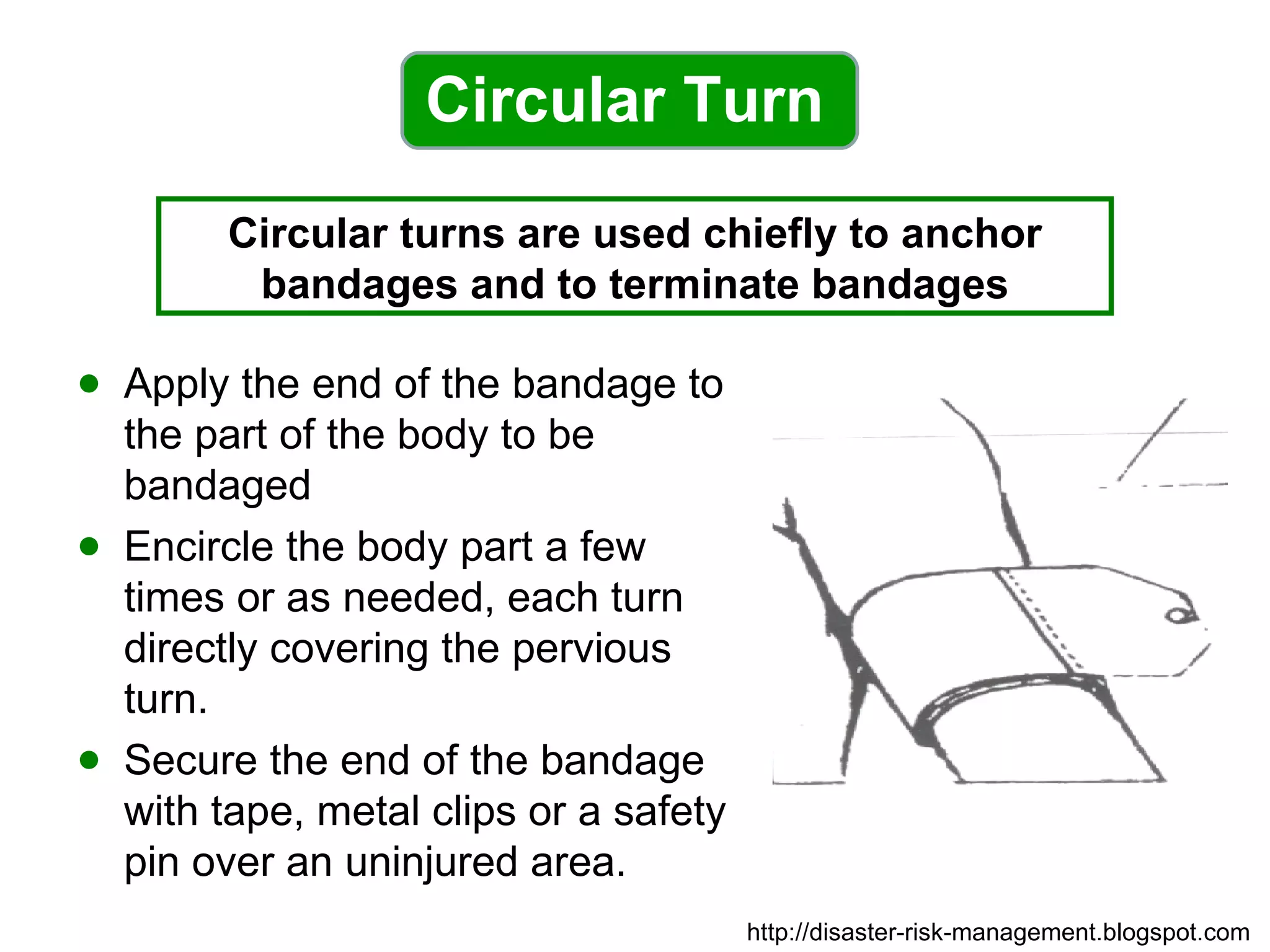 Bandaging | PPT