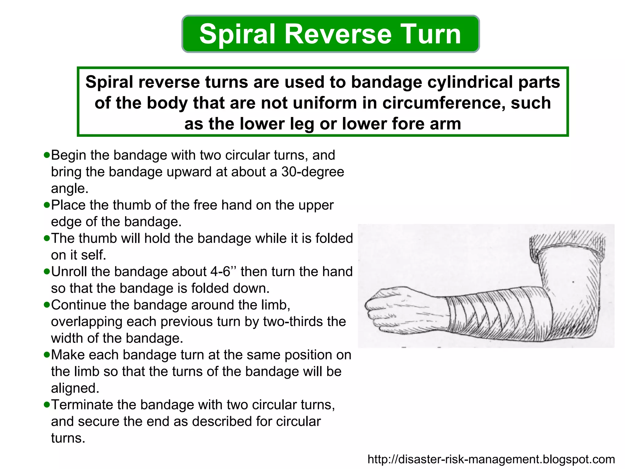 Bandaging | PPT