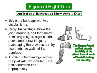Bandaging | PPT