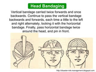 Bandaging | PPT | First Aid | Injuries
