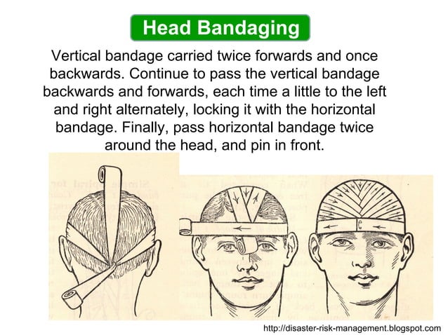 Bandaging | PPT | First Aid | Injuries
