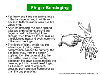 Bandaging | PPT
