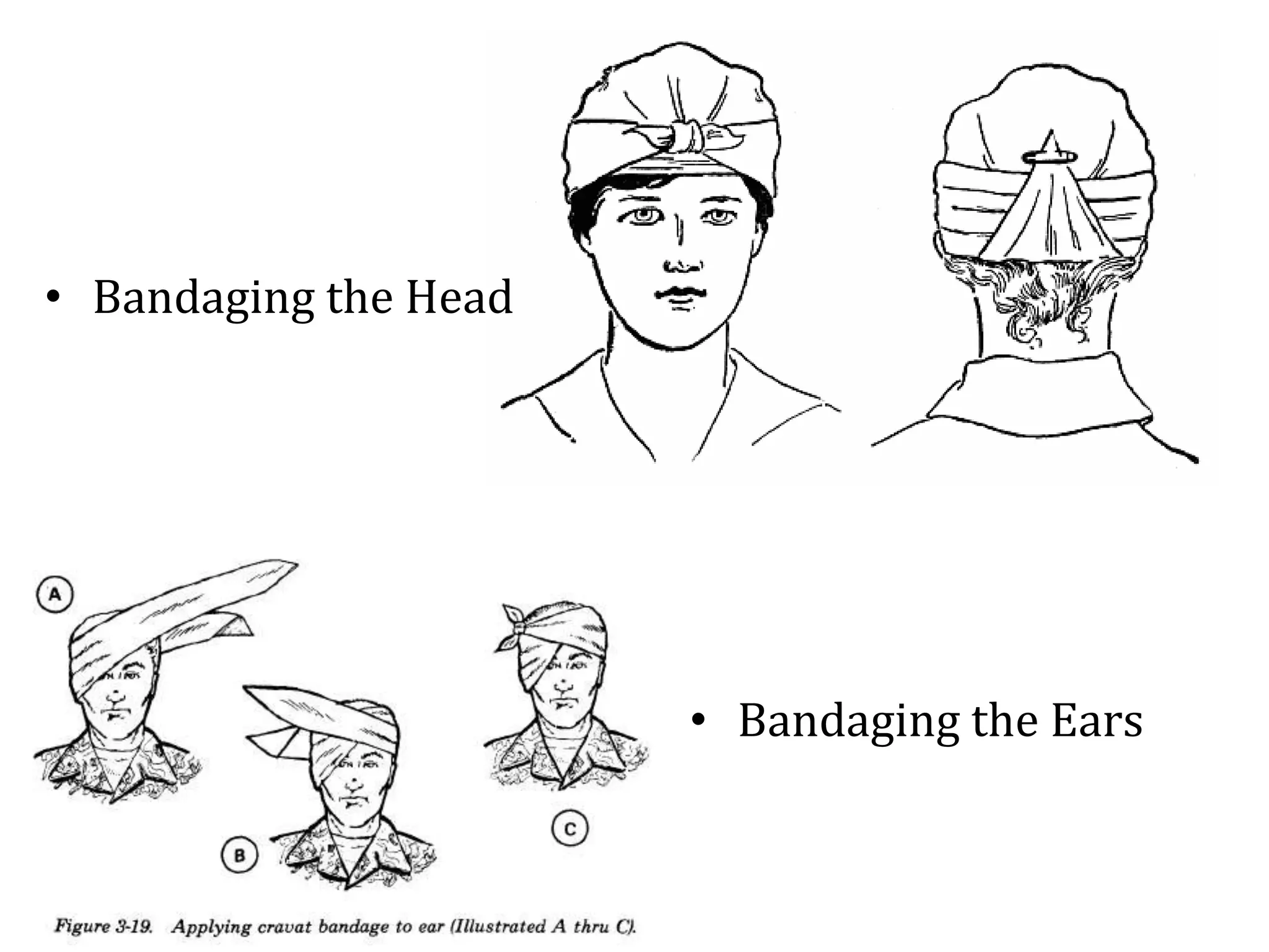 Bandaging and Splinting & Slings; Techniques and Types (Health Subject ...