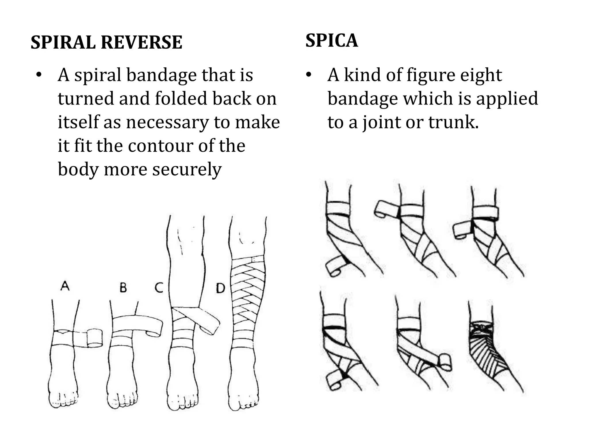 Bandaging and Splinting & Slings; Techniques and Types (Health Subject ...