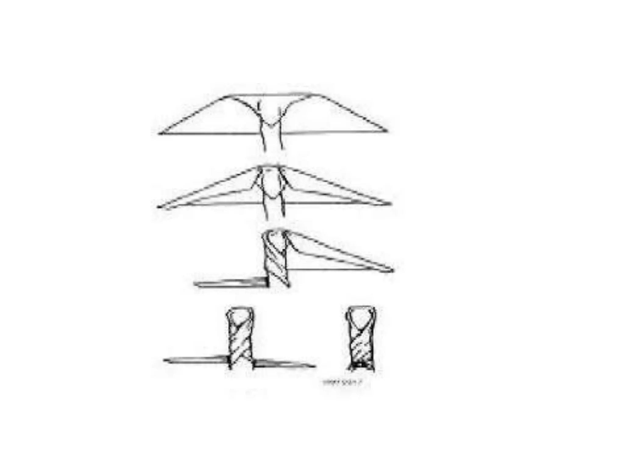 Bandaging and Splinting & Slings; Techniques and Types (Health Subject ...