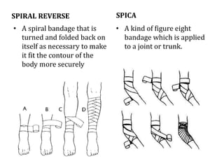 Bandaging and Splinting & Slings; Techniques and Types (Health Subject ...