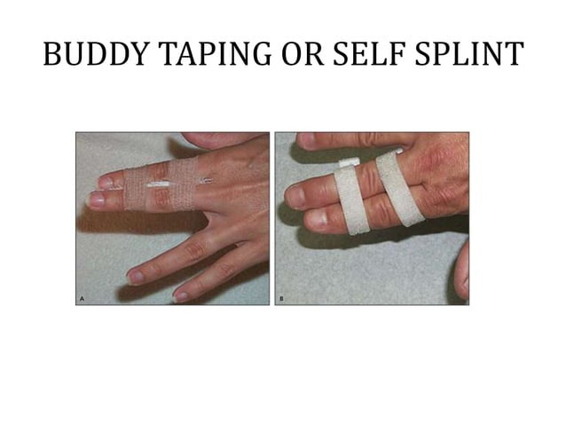 Bandaging and Splinting & Slings; Techniques and Types (Health Subject ...