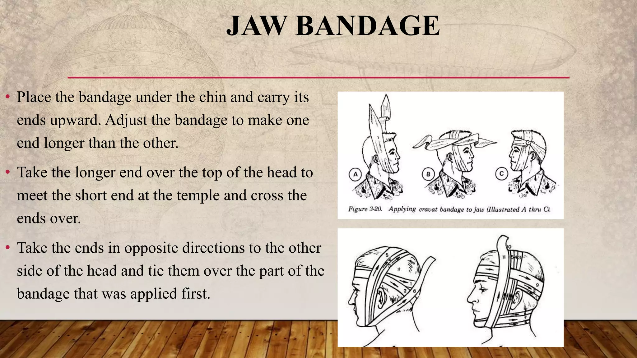 Bandaging | PPTX