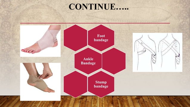 Bandaging | PPTX