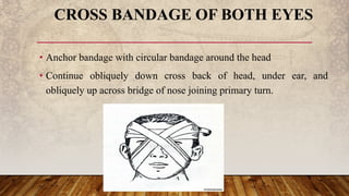 Bandaging | PPTX