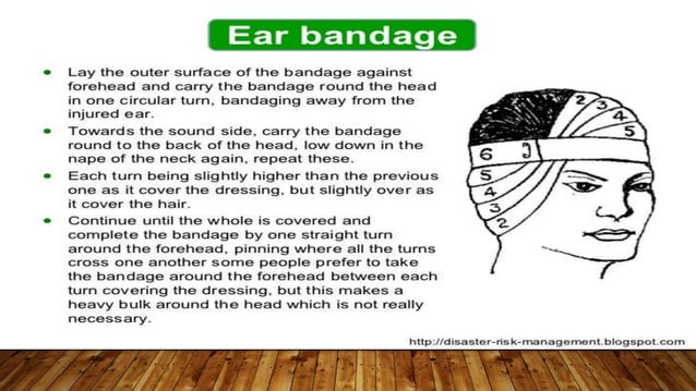 Bandaging | PPTX