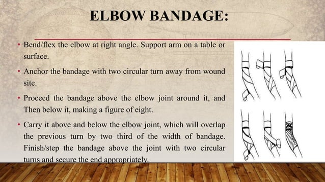Bandaging | PPTX