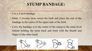 Bandaging | PPTX