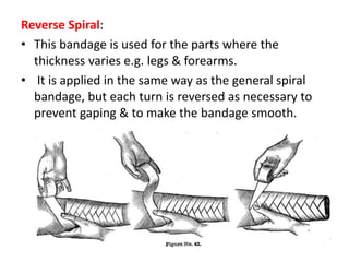 Bandaging | PPTX