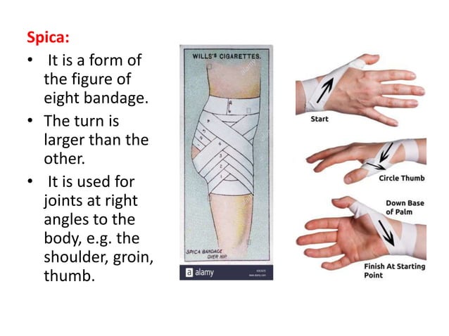 Bandaging | PPTX | First Aid | Injuries
