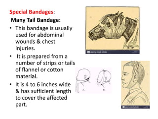 Bandaging | PPTX