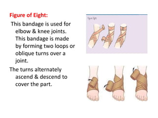 Bandaging | PPT