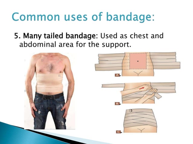 Bandaging Basics For Nursing Students | PPTX | First Aid | Injuries