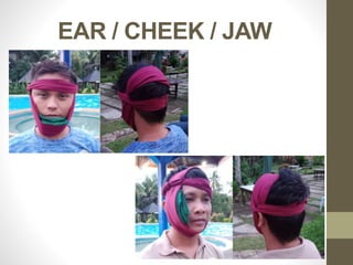 Bandaging-Techniques (1).pptx