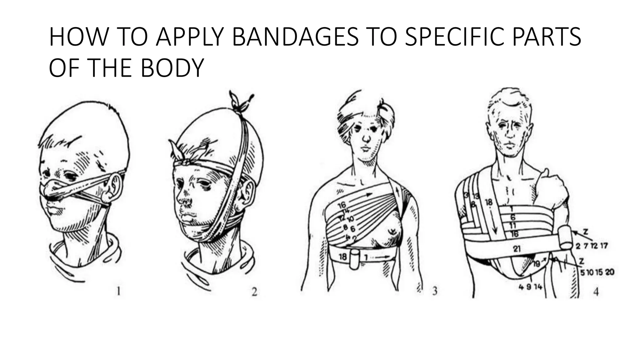 Bandaging and dressing | PPTX