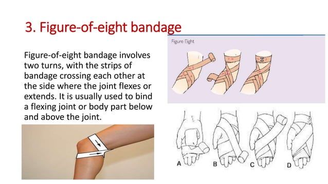 Bandaging and dressing | PPTX | First Aid | Injuries