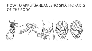 Bandaging and dressing | PPTX