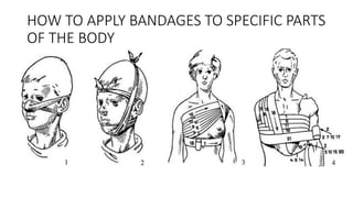 Bandaging and dressing | PPTX