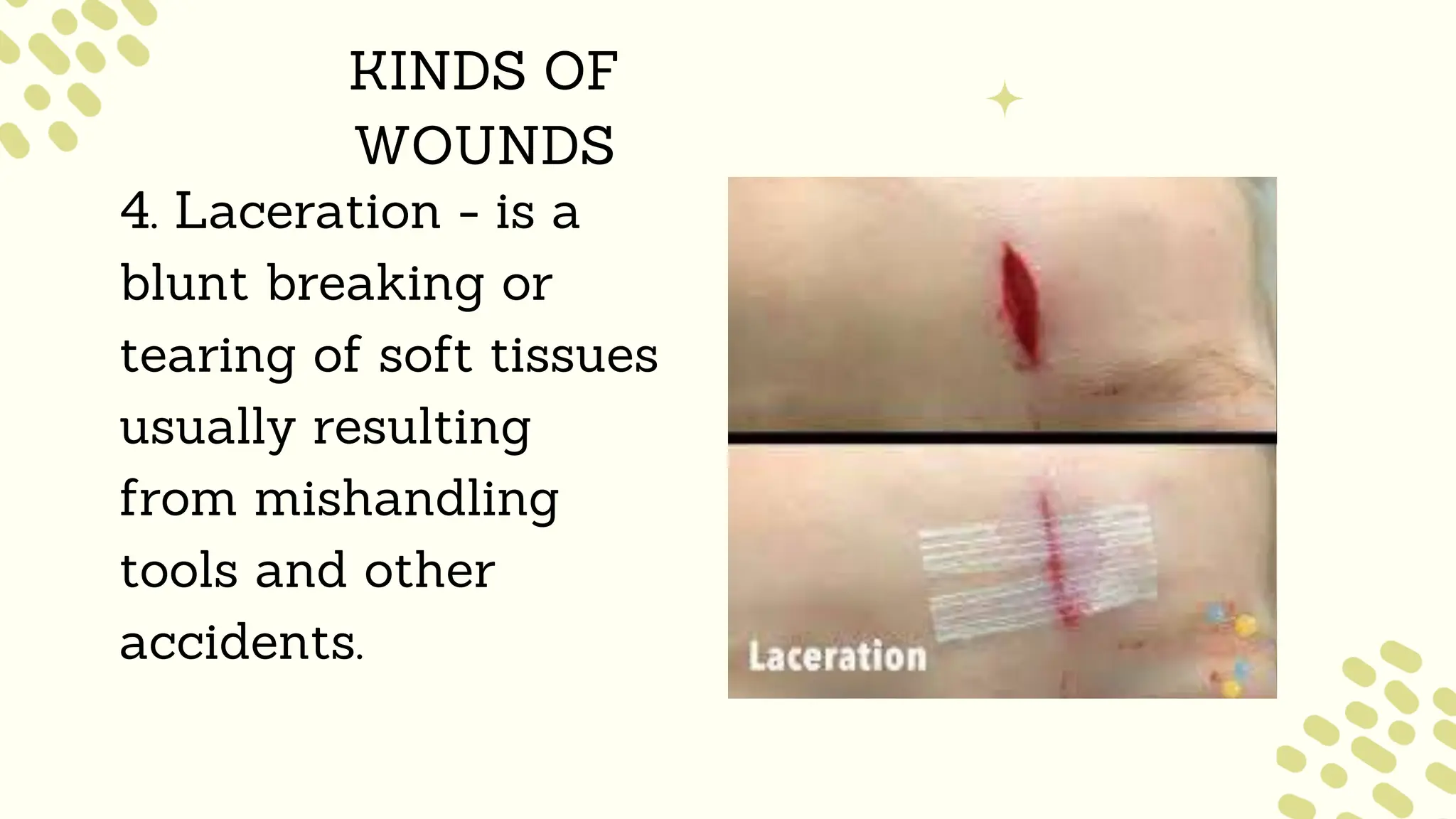 Grade 9- Health, Lesson 3: Bandaging and Dressing .pptx