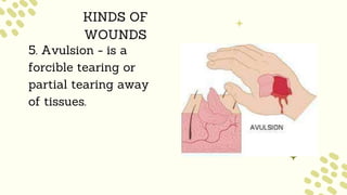 Grade 9- Health, Lesson 3: Bandaging and Dressing .pptx