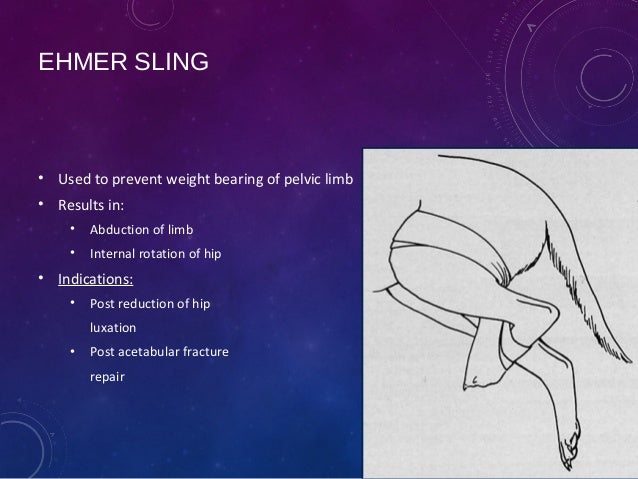 Bandaging principles and techniques