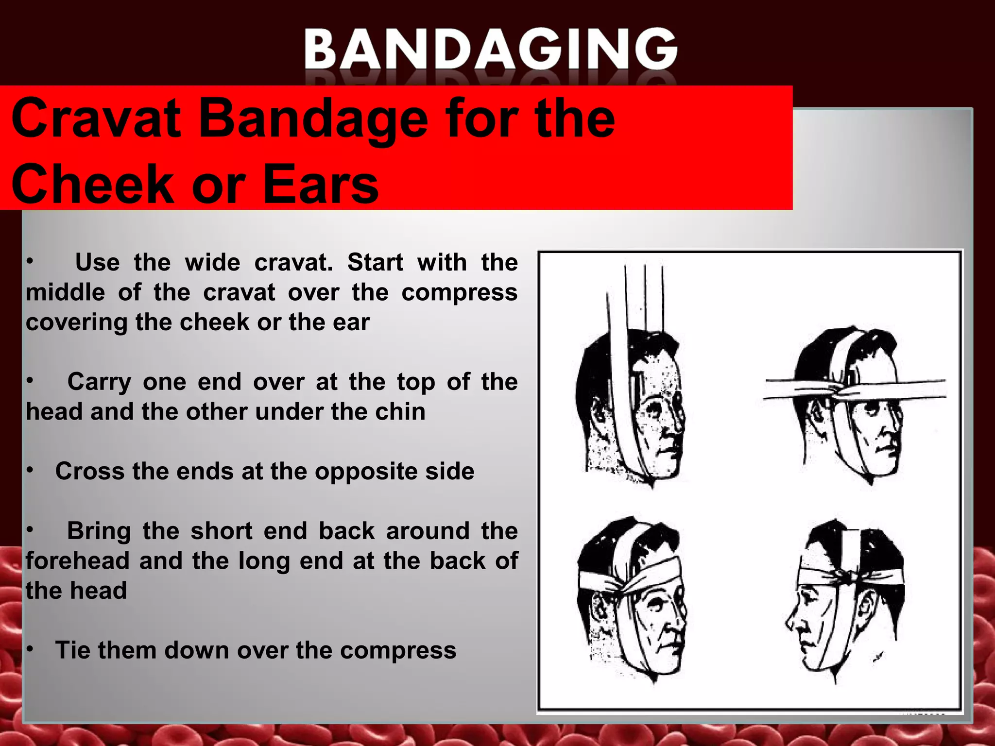 Bandaging&splinting | PPT