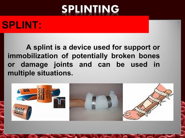 Bandaging&splinting | PPT | First Aid | Injuries