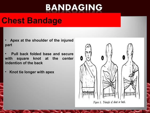 Bandaging&splinting | PPT | First Aid | Injuries