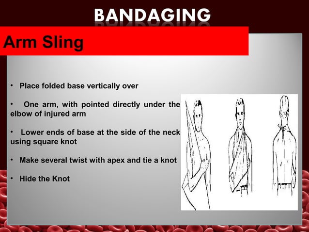 Bandaging&splinting | PPT | First Aid | Injuries