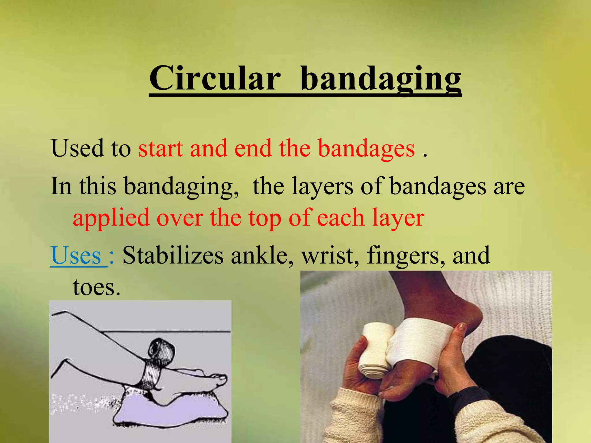Bandaging technique | PPT