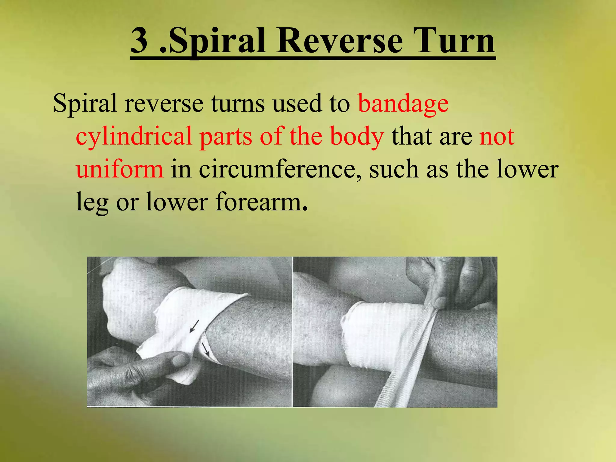 Bandaging technique | PPT