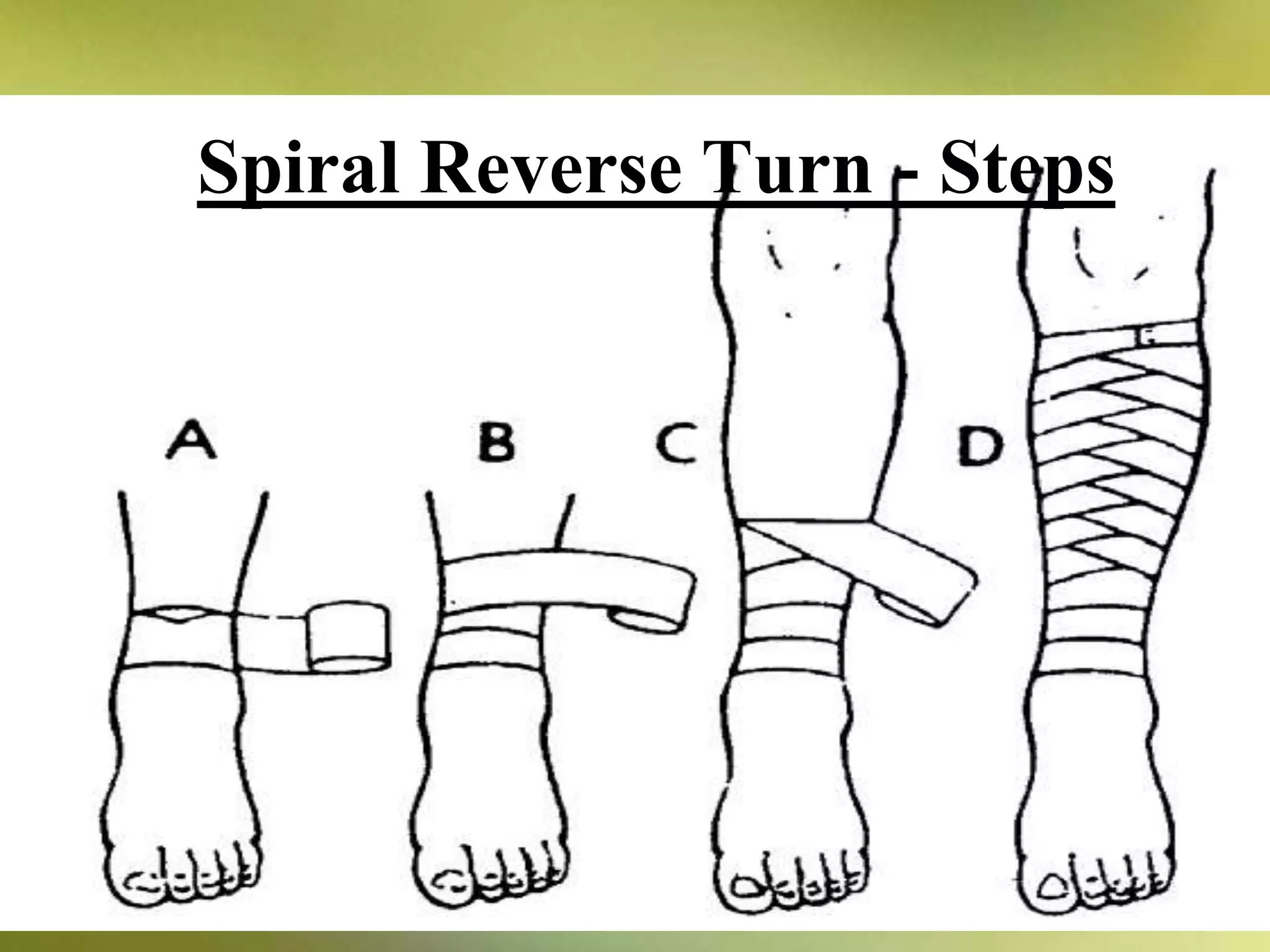Bandaging technique | PPT