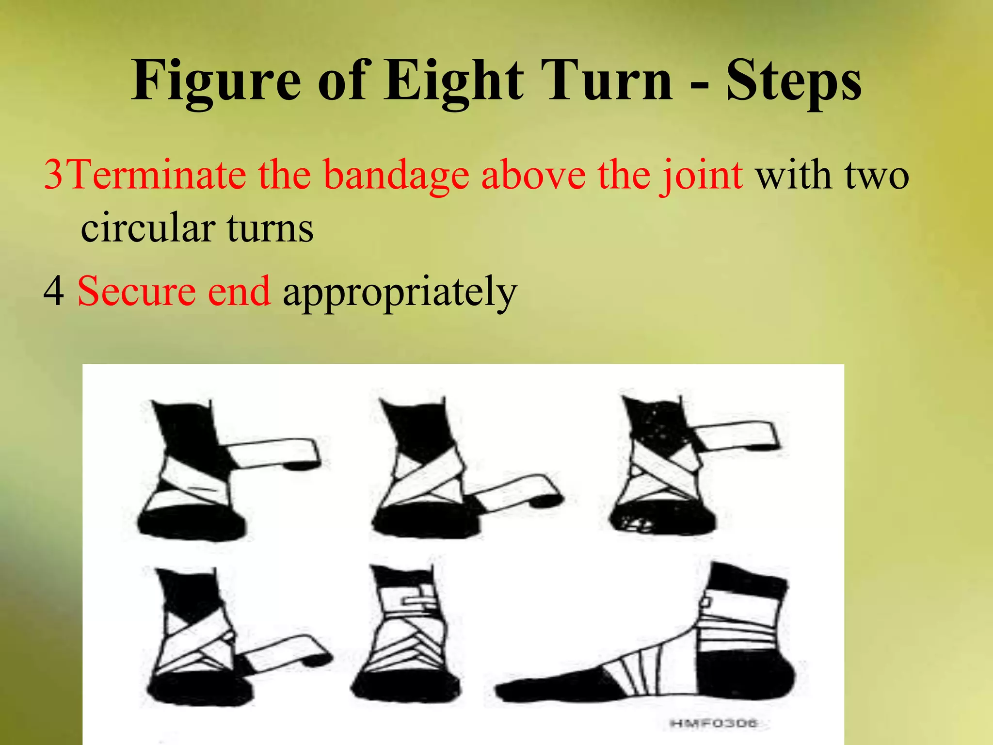 Bandaging technique | PPT