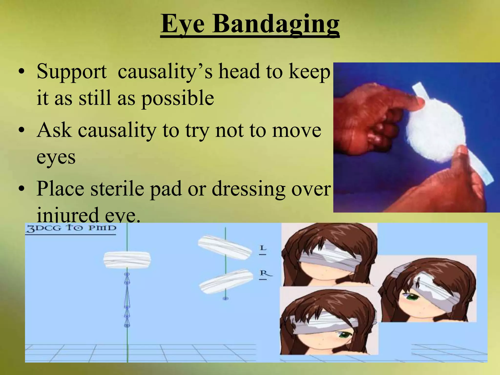 Bandaging technique | PPT