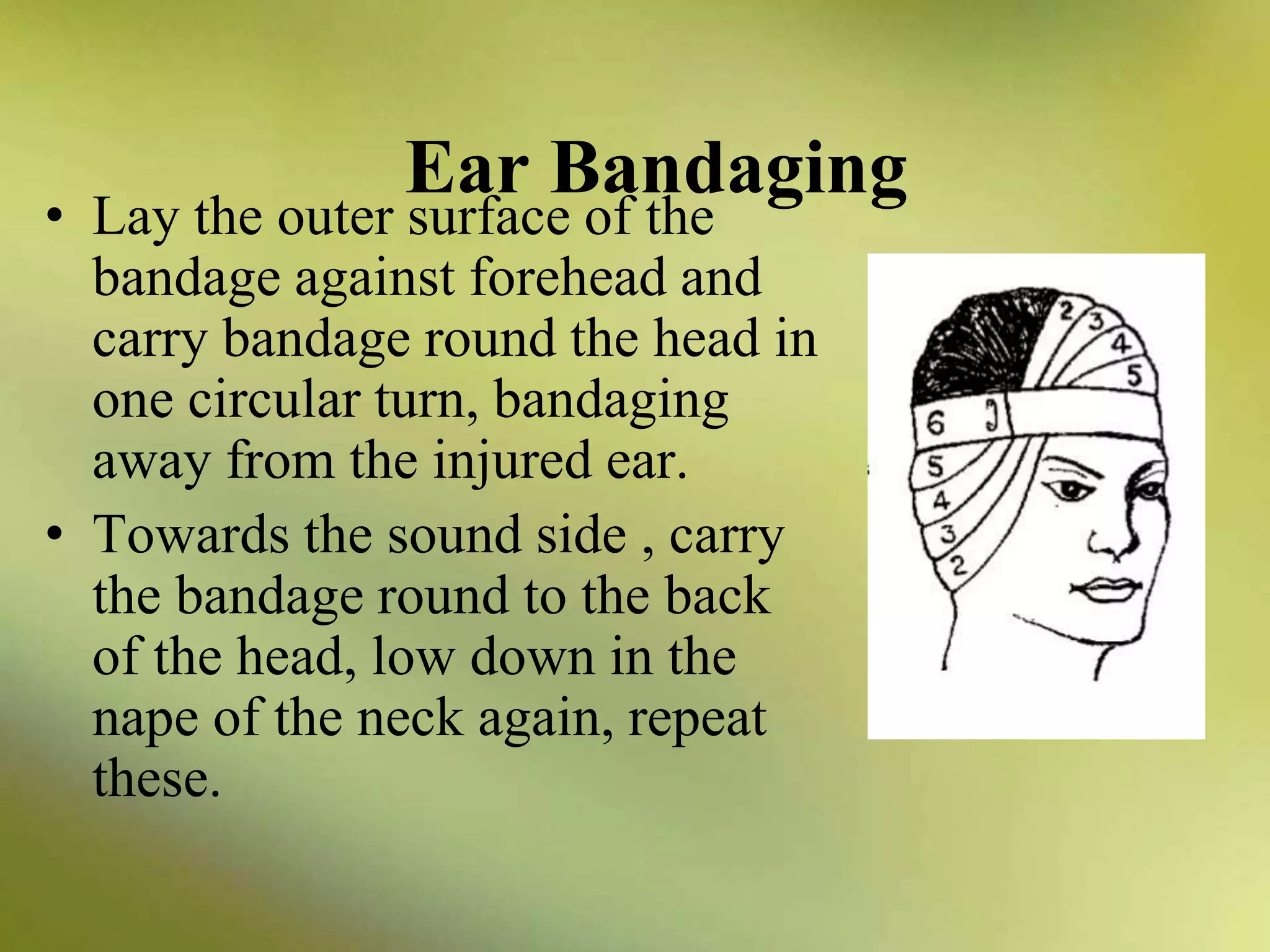 Bandaging technique | PPT