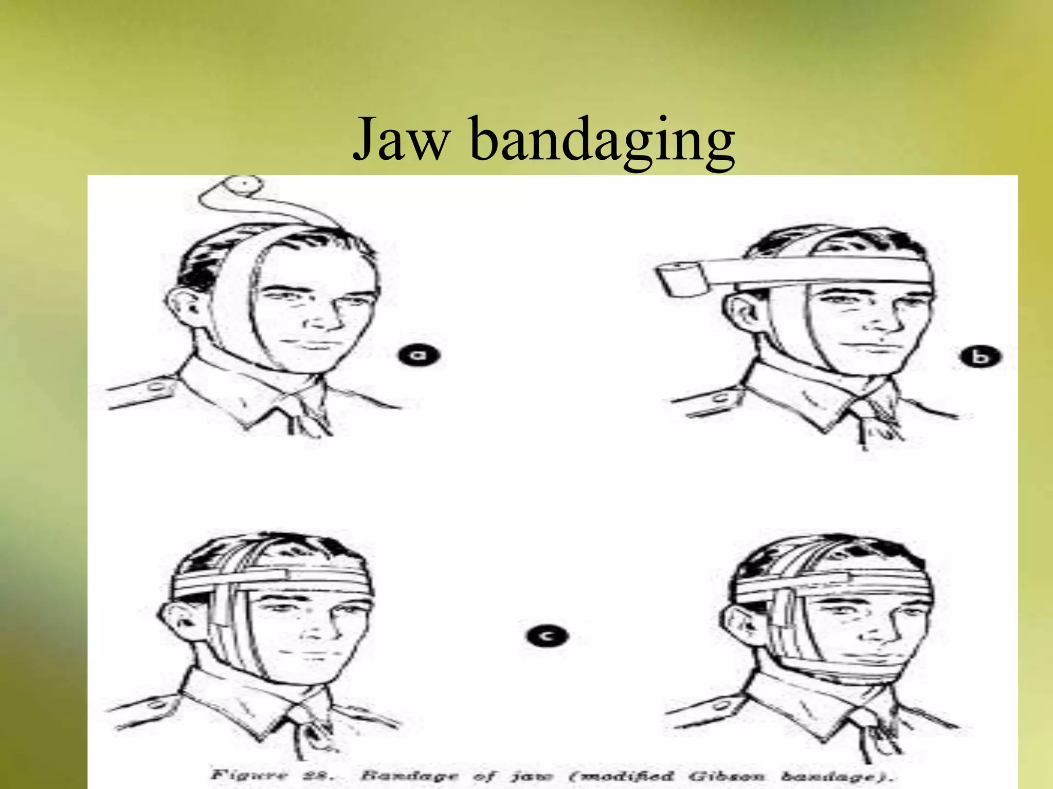 Bandaging technique | PPT